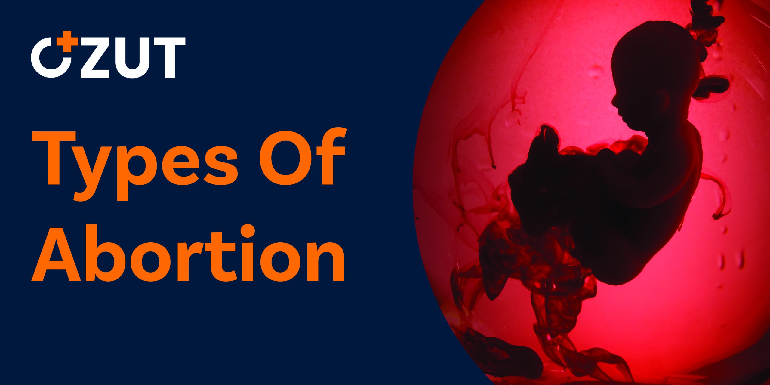 Comparing Medication and Procedural Abortion Methods: Safety, Efficacy ...